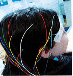 Electroencephalogram (EEG) Test PIAG 69 - Alder Hey Children's Hospital ...