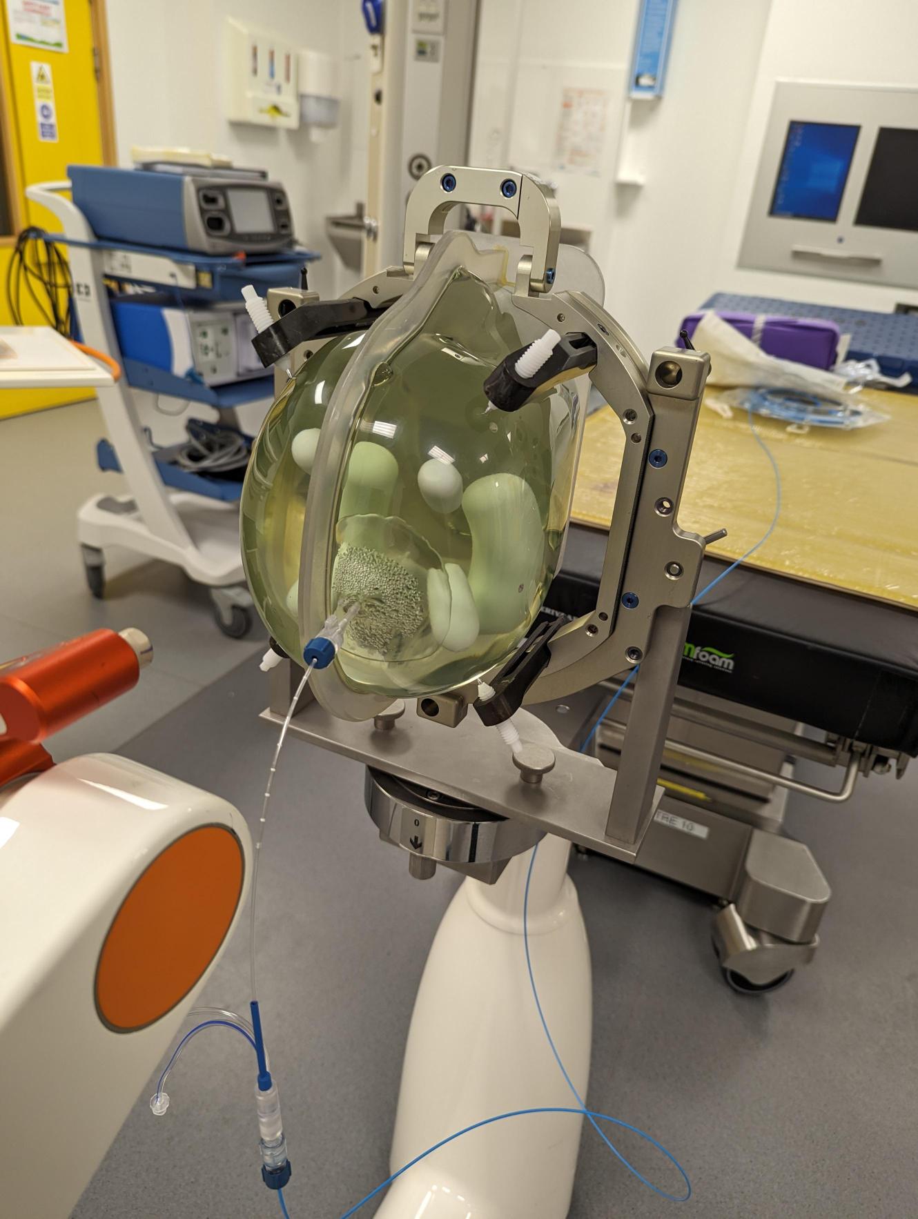 Alder Hey performs new groundbreaking epilepsy treatment - Alder Hey ...