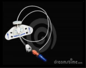 Caring for your child's PICC line at home PIAG 07 - Alder Hey Children ...