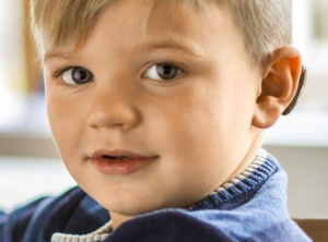 Bone conduction hearing devices (BCHDs) - Alder Hey Children's Hospital ...